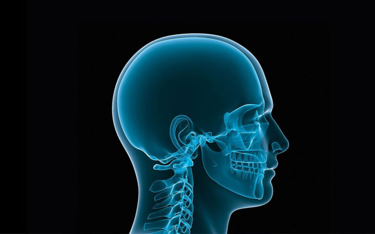 Understanding Craniomaxillofacial Surgery